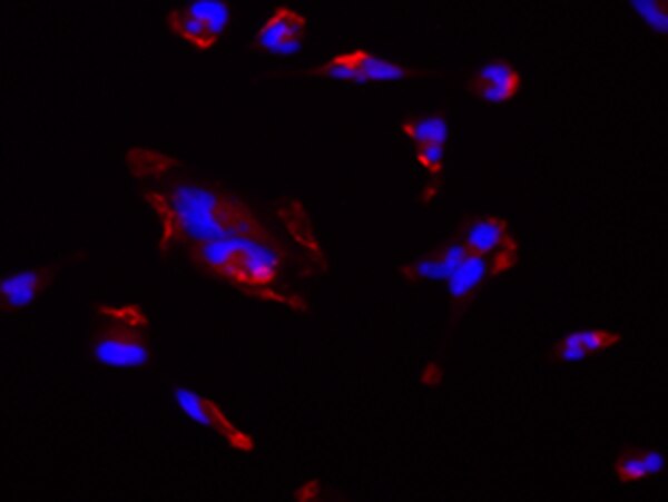 SK-MEL-147 Human Melanoma Cell Line | SCC440